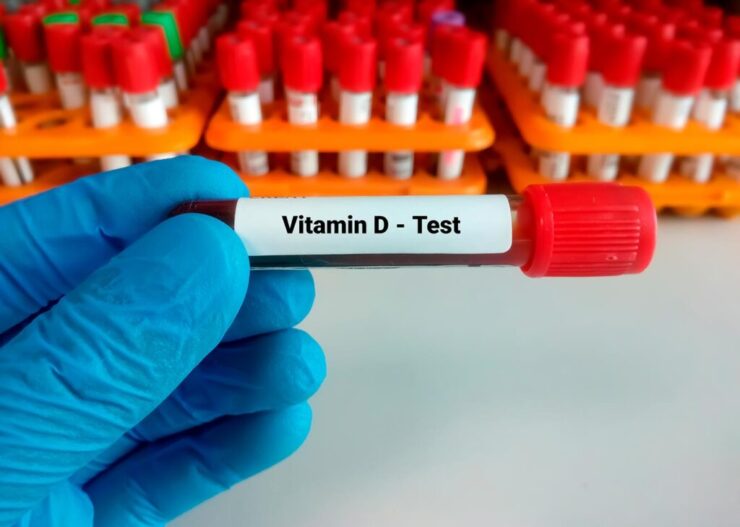 At Home Vitamin D Test: Things You Should Know - Honestly Fit